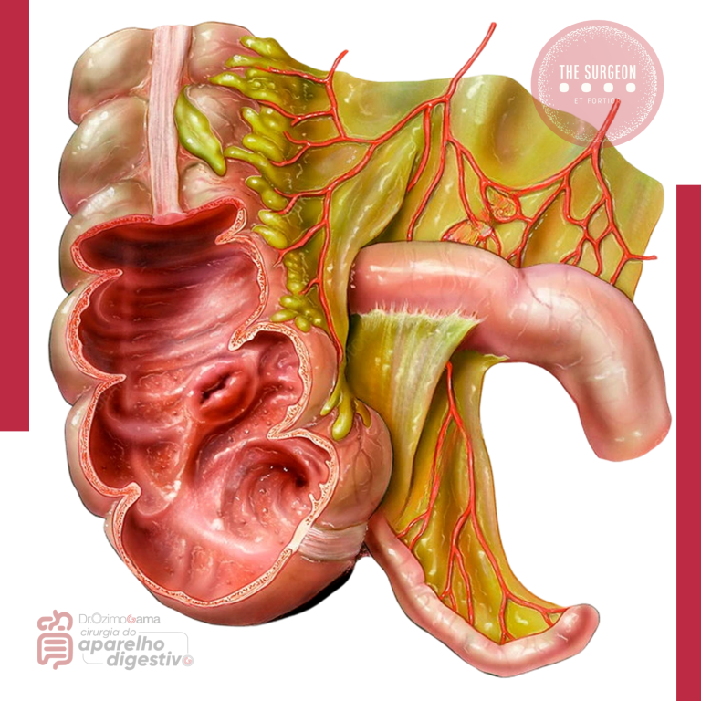 Qual a função do Apêndice Vermiforme? | The SURGEON